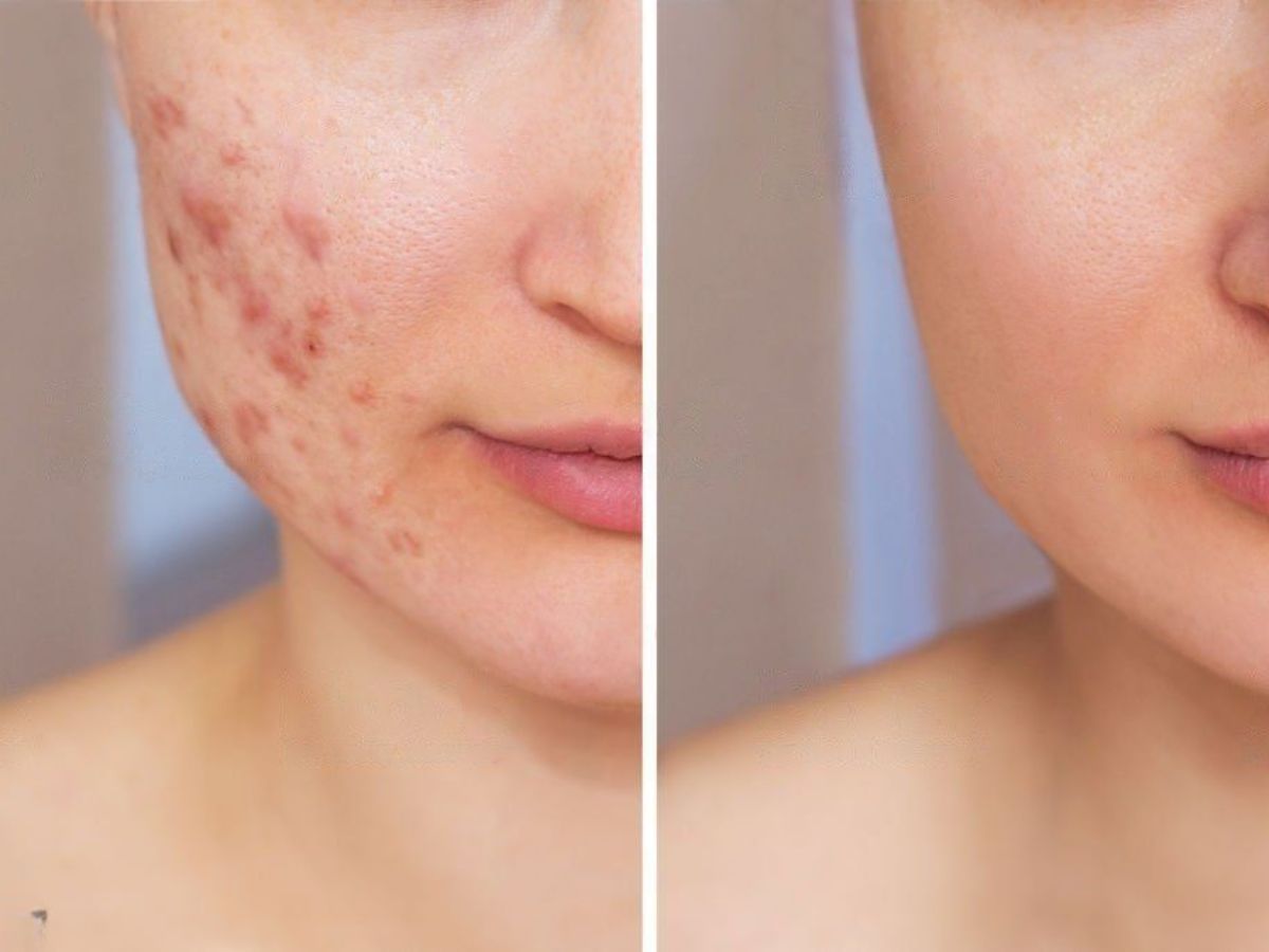 5 Skin Benefits of Calendula - Empowering your brand with our top OEM ...