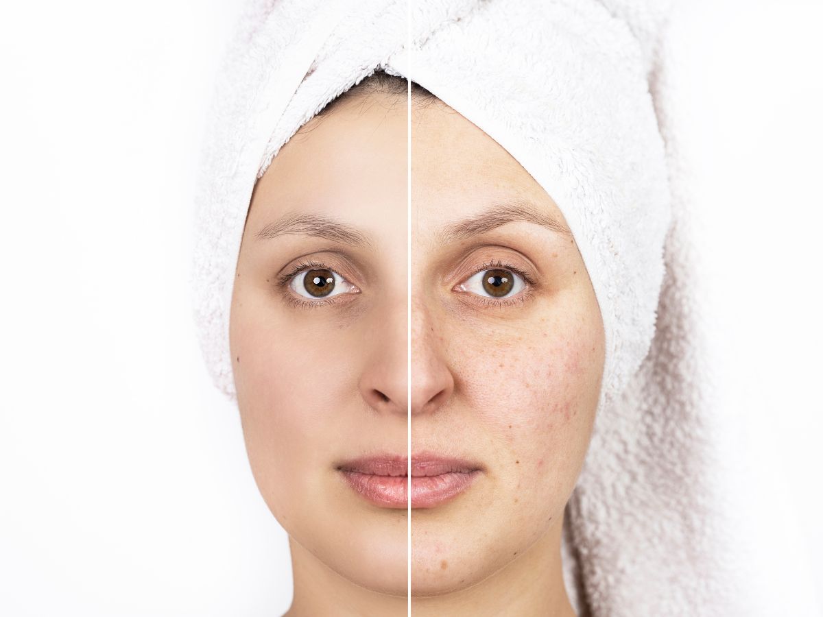 The Ultimate Guide to Centella Asiatica Skincare - Empowering your ...